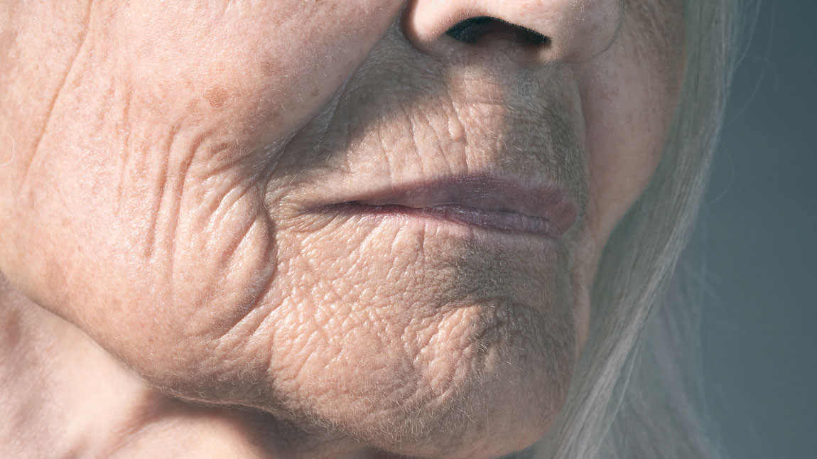 Crepey Skin: Treatments, Causes & Prevention Tips - The Cosmetic Studio ...